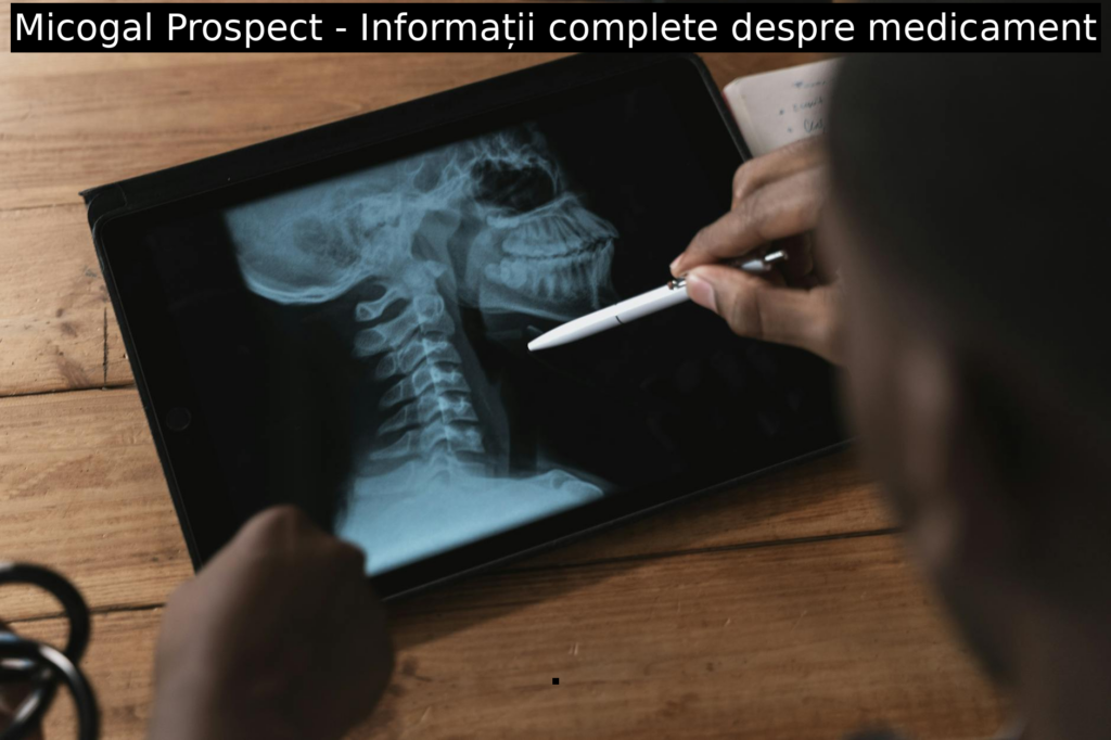 Clorzoxazona: beneficii și utilizări în tratamentul durerilor și ...